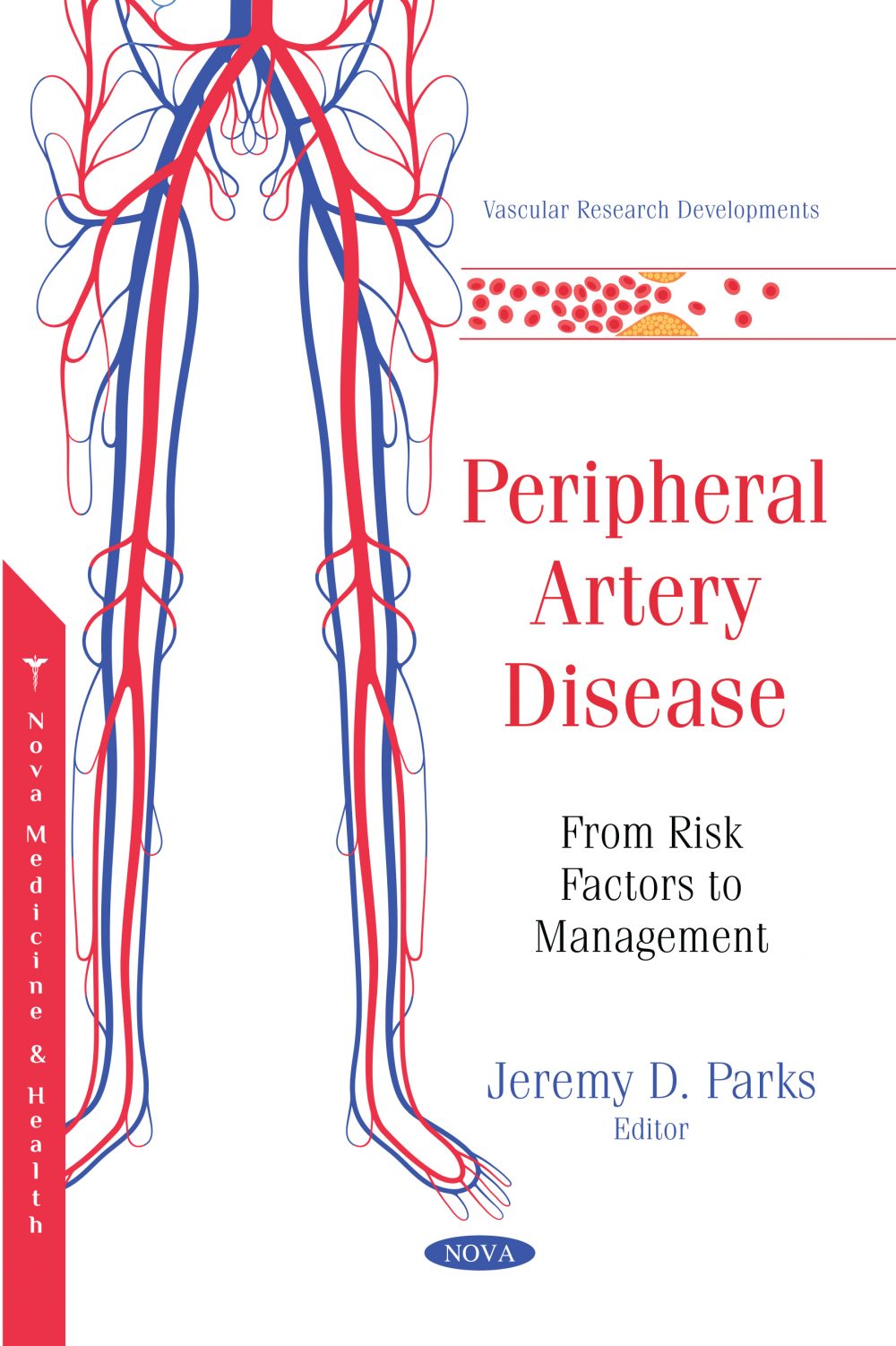 Peripheral Artery Disease From Risk Factors To Management Original